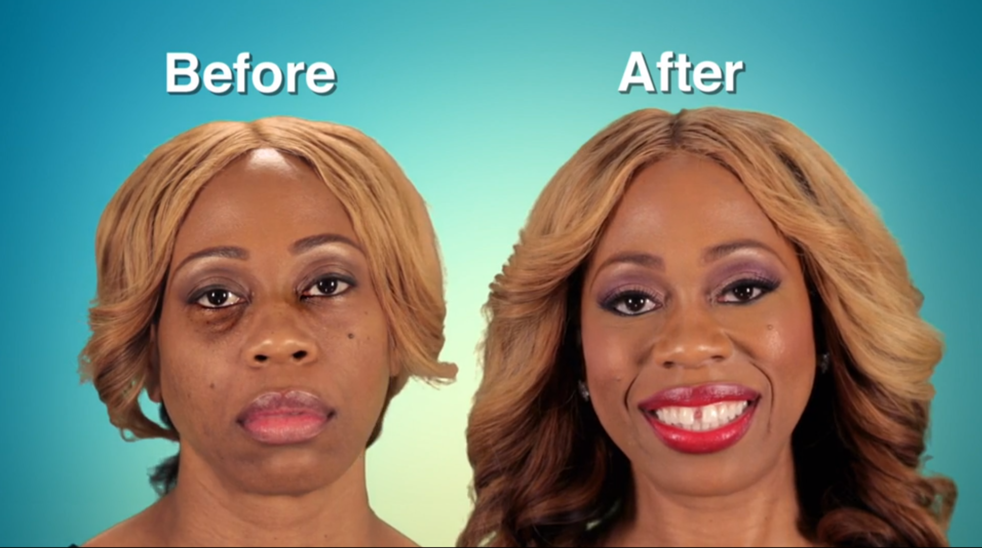 Season 2 Before & After - Atlanta Plastic | Lifetime