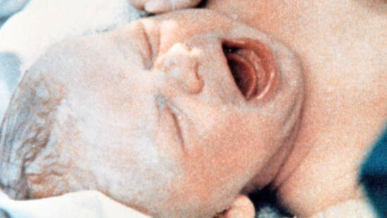 Real Test Tube Baby